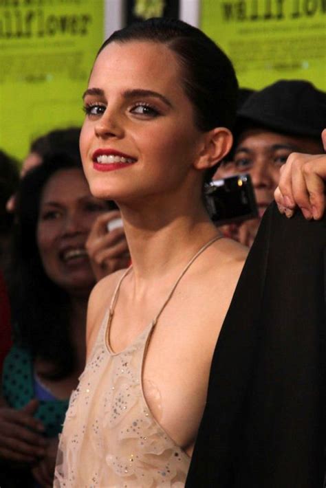 Yet Another Emma Watsons Wardrobe Malfunction Barnorama