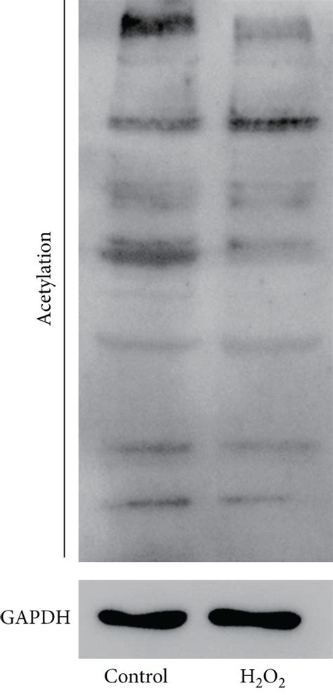 Global Proteomic Analysis Of Lysine Acetylation In Senescent