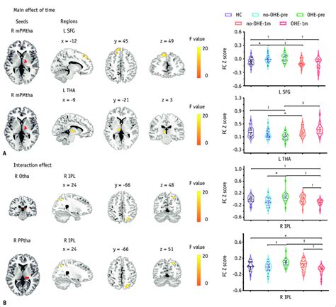 Main Effect Of Time And Interaction Effect In Thalamic Functional