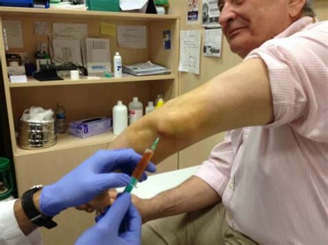 Bursitis En El Codo Causas Síntomas Y Tratamiento Blog Clínica Privada Jaime I Catarroja En