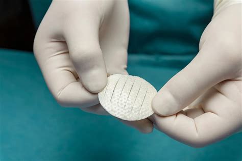 Kerecis Expands Silicone Fish Skin Combination Product Range Kerecis