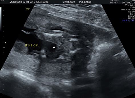 Did They Tell Us The Wrong Gender Mumsnet Did They Tell Us The Wrong Gender Mumsnet