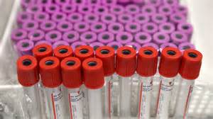 Fda Rules On Health Claims Vs Structure Function