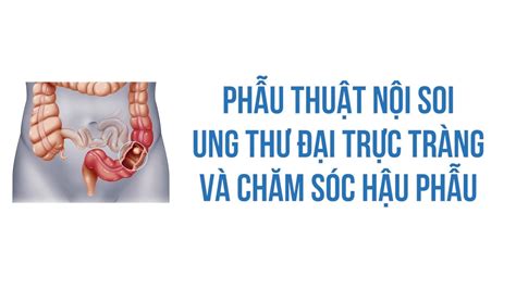 Ph U Thu T N I Soi Ung Th I Tr C Tr Ng V Ch M S C H U Ph U Ptq Youtube