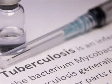 Tuberculosis And Diabetes And Are Linked Heres What The Research Reveals Tuberculosis And