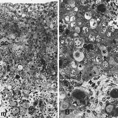 Semithin Sections Of Fetal Human Ovary A Ovarian Cortex With Sex