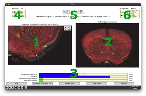 Labeling Tool Atlas Alignment