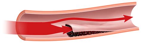 1 What Is Scad Scad Alliance