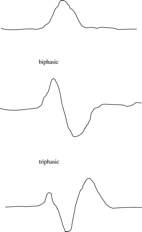 Figure 1 From The Relation Between Electrodermal Activity In Sleep Negative Activity Affect