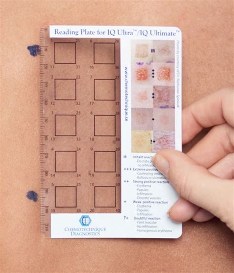 Skin Patch Test Skin Patch Test Hong Kong Skin Patch Test Hk Patch Test Allergens Allergen
