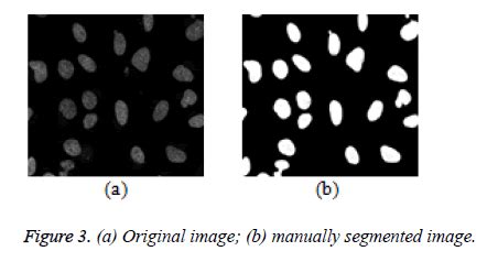 Selective Cell Segmentation Using Semi Automatic Graph Cut With Adaptive Distance Penalties