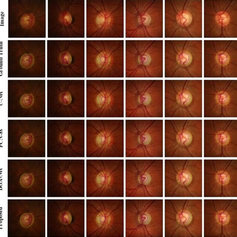 Visualization Of Optic Disc And Optic Cup Segmentation Results In The Download Scientific