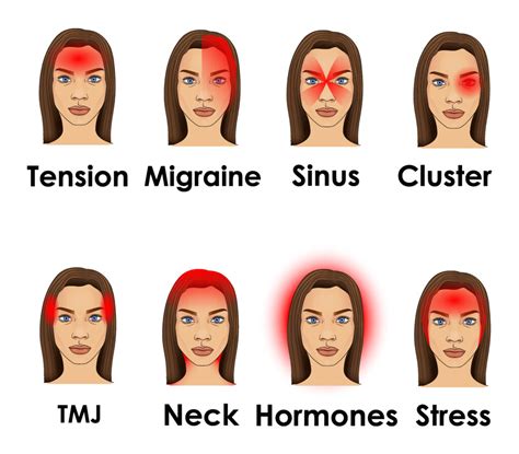 Bowen Therapy For Headaches Bowen Therapy For Migraines