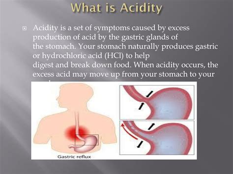 Ppt Acidity Powerpoint Presentation Free Download Id7429263