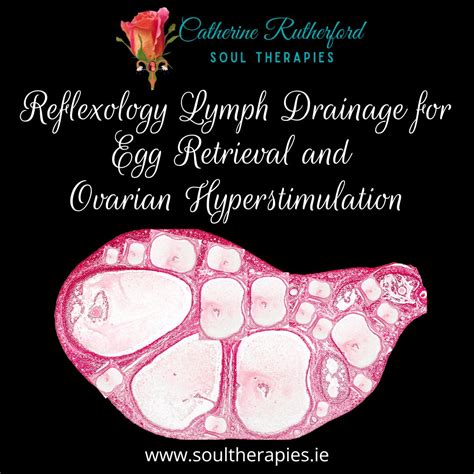 Catherine Rutherford ~ Soul Therapies On Linkedin 🥚egg Retrieval And