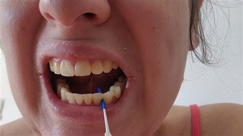 Satisfying Interdental Adventure Getting Up Close With Every Tooth