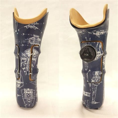 Prosthetic Socket Types At George Cho Blog