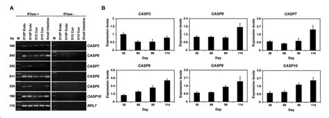 Expression Of CASP3 CASP6 CASP7 CASP8 CASP9 And CASP10 By Download Scientific Diagram