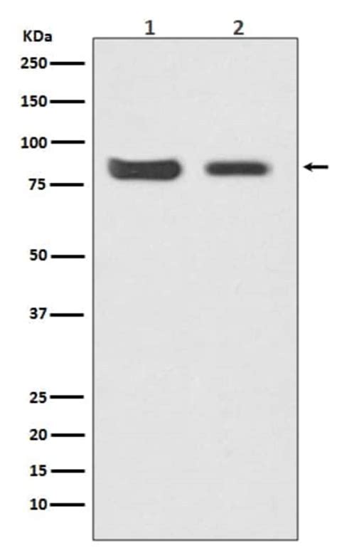 Mitofusin 2 Antibody Sr2236 Novus Biologicalsantibodiesprimary