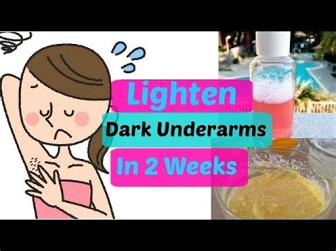 How to Lighten DARK UNDERARM Permanently in 2 Easy Steps | Dark underarms treatment & Home ...
