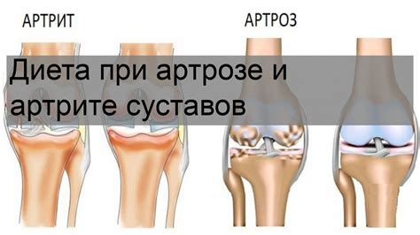 Диета при артрозе и артрите суставов Youtube