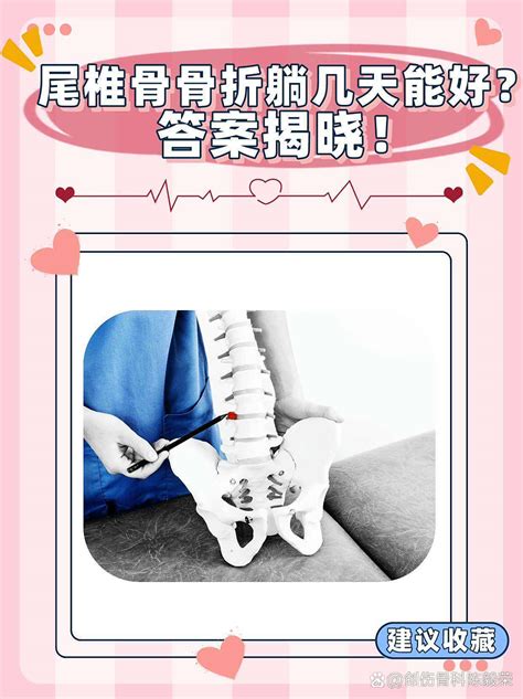 【尾椎骨骨折躺几天能好？