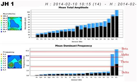 How To Read A Lens Neurofeedback Brain Map