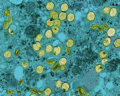 Nih Trial Confirms Mpox Vaccine Safety And Efficacy In Adolescents