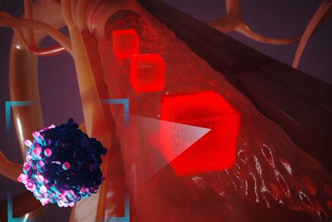 Modelling A Single Cancer Cell In A Sea Of Blood Physics World