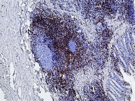 Antigen Retrieval Buffer20xcitrate Buffer Of Ph60 产品 Immunoway 中文官网