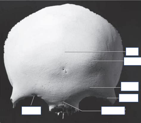 Frontal Bone Anteriorectocranial Diagram Quizlet