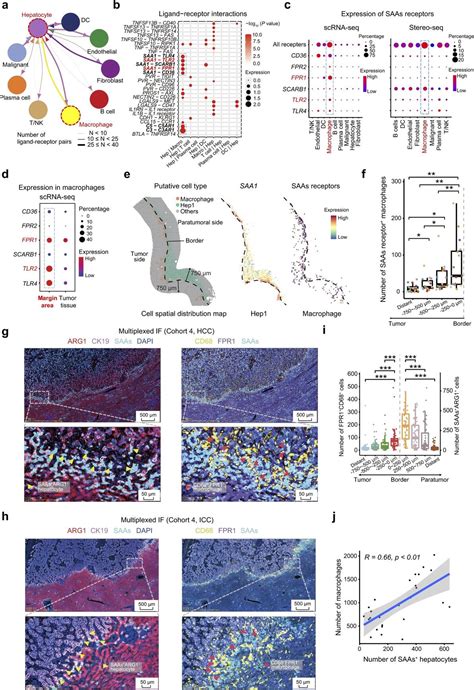 Cell Res 人肝癌侵袭区可促进肝细胞 肿瘤细胞串扰、局部免疫抑制和肿瘤进展 哔哩哔哩