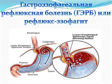 Патология желудочно кишечного тракта презентация онлайн