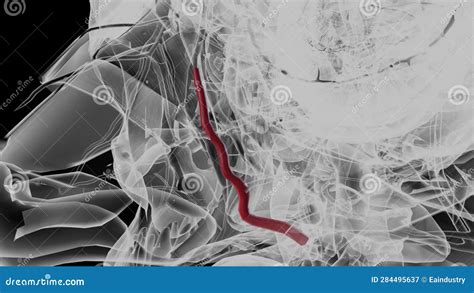 Angular Artery Is An Artery Of The Face Stock Video Video Of