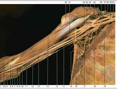 Anterior Forearm Cadaver Diagram Quizlet