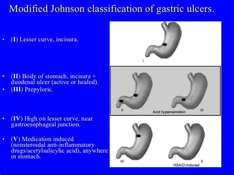 Bohomolets Surgery 4th Year Lecture 7