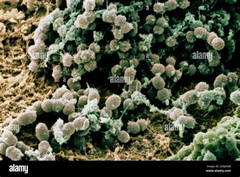 False Colour Scanning Electron Micrograph Sem Of Colonies Of An Unidentified Species Of