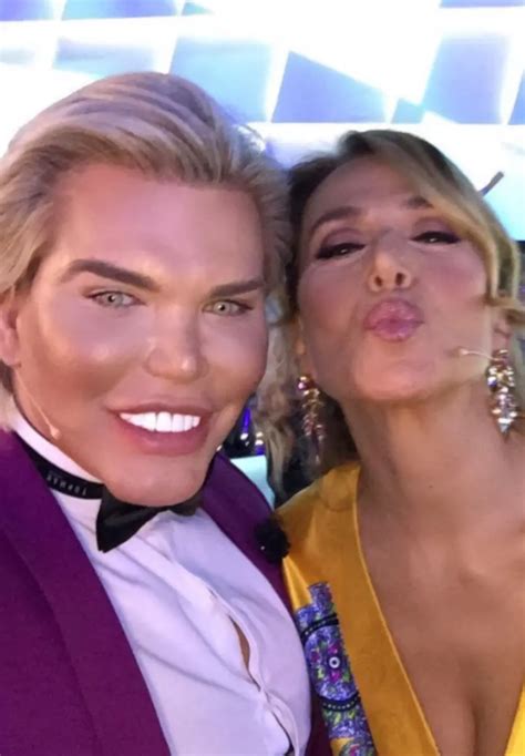 La Barbie Umana Vuole Diventare Mamma Pronta Per Il Trapianto Dellutero