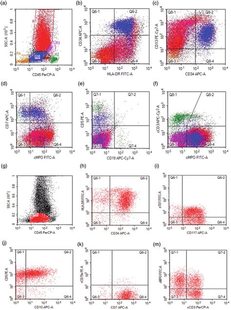 Flow Cytometry Shows A Population Of Blasts With Acute Myeloid Leukemia