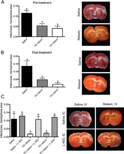 Relaxin Peptide Treatment 30 Minutes Before And After Pmcao Decreased