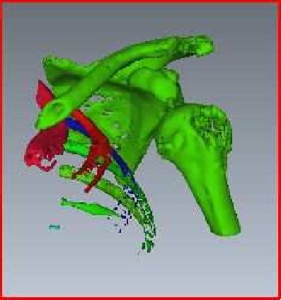 Automatic Segmentation Download Scientific Diagram