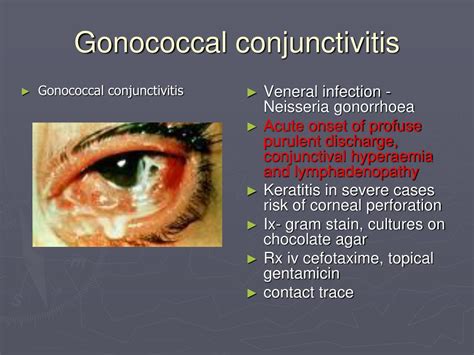 Gonorrhea Symptoms Eyes Ezgross