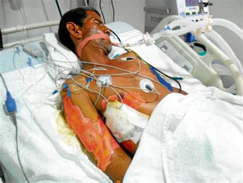 Indagación Preliminar Por Caso De Quemado En La Uci De La Clínica Valle