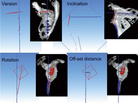 The Four Position Parameters Version Inclination Rotation And Download Scientific Diagram
