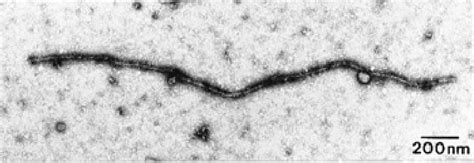 Immunosorbent Electron Microscopy Detection Of A Pineapple Mealybug Download Scientific Diagram
