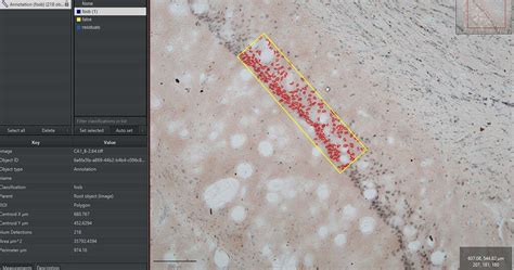 how to quantify positive dab cell on multiple images image analysis
