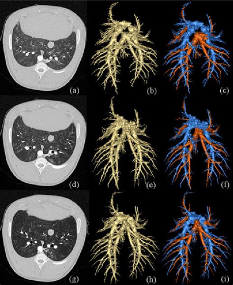 figure 10 from a new paradigm of interactive artery vein separation in