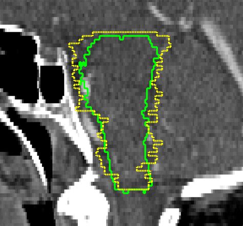 Examples Of Segmentations Every Image Pair Shows A Comparisons Between