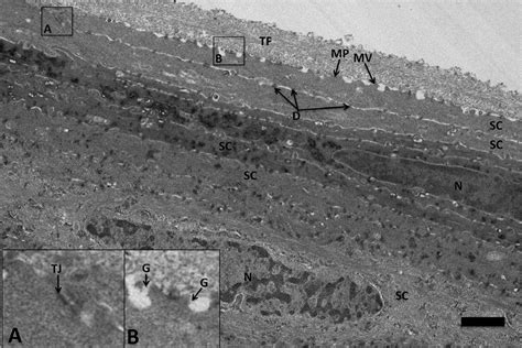Transmission Electron Micrograph Squamous Cell Layer Of Cornea The