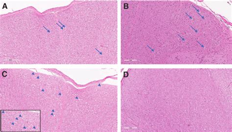 Microscopic Spinal Cord Findings At 2 6 13 And 52 Weeks Of Download Scientific Diagram